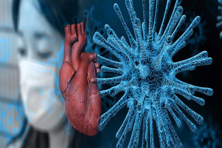 Covid-19 and Cardiovascular Disease - Preventive Cardiology: It's about ...